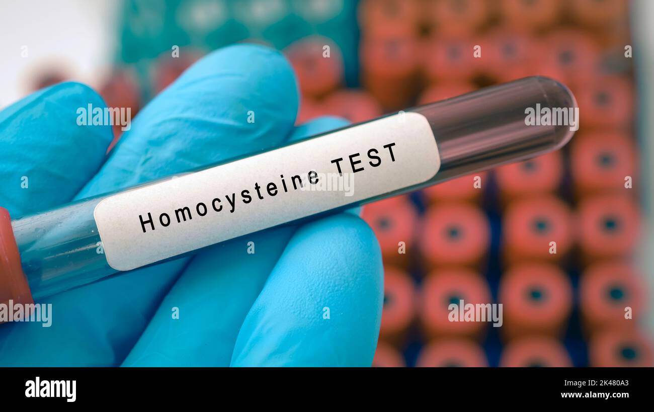 Homocysteine hi-res stock photography and images - Alamy