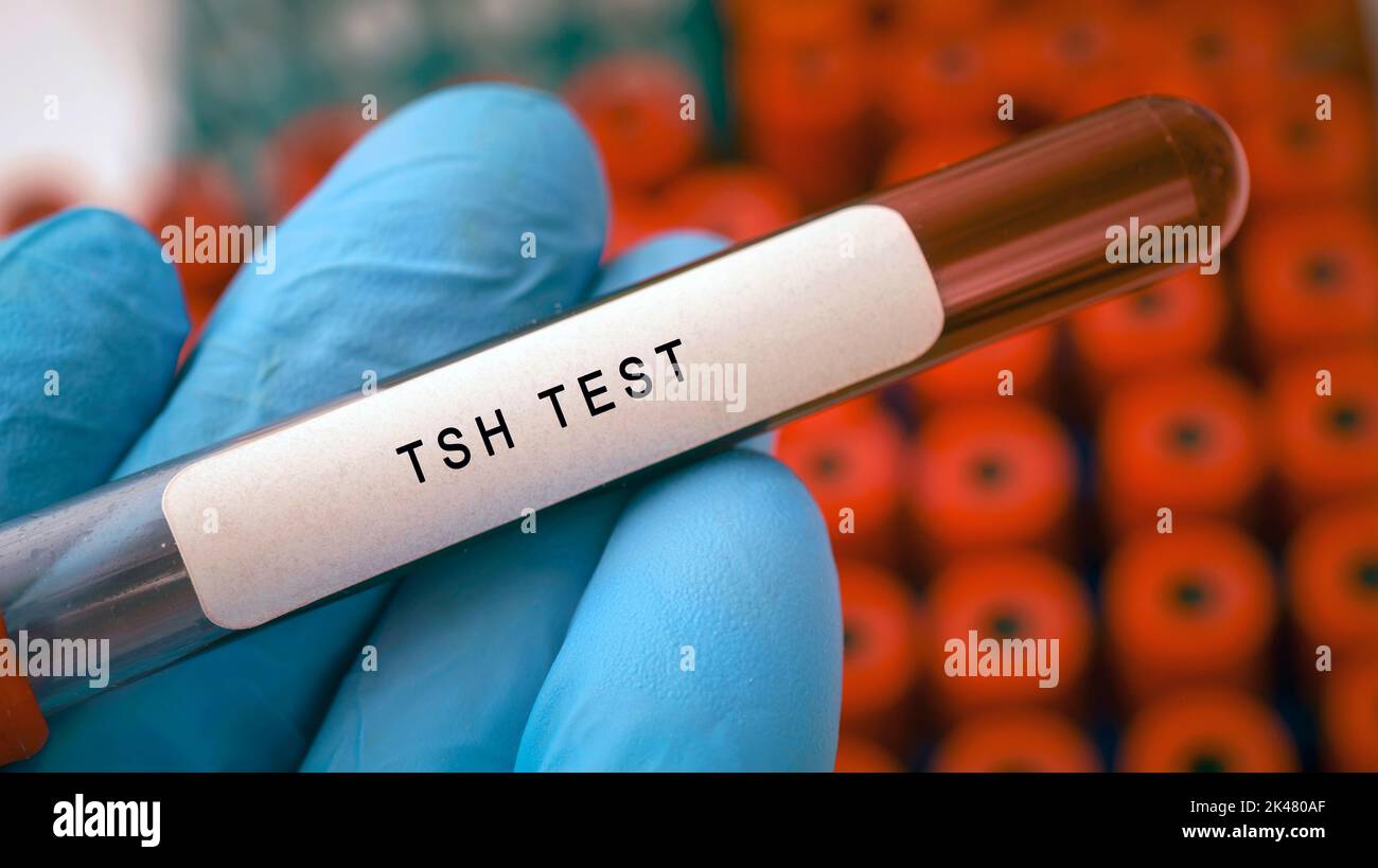 Thyroid stimulating hormone (TSH) test, conceptual image Stock Photo ...