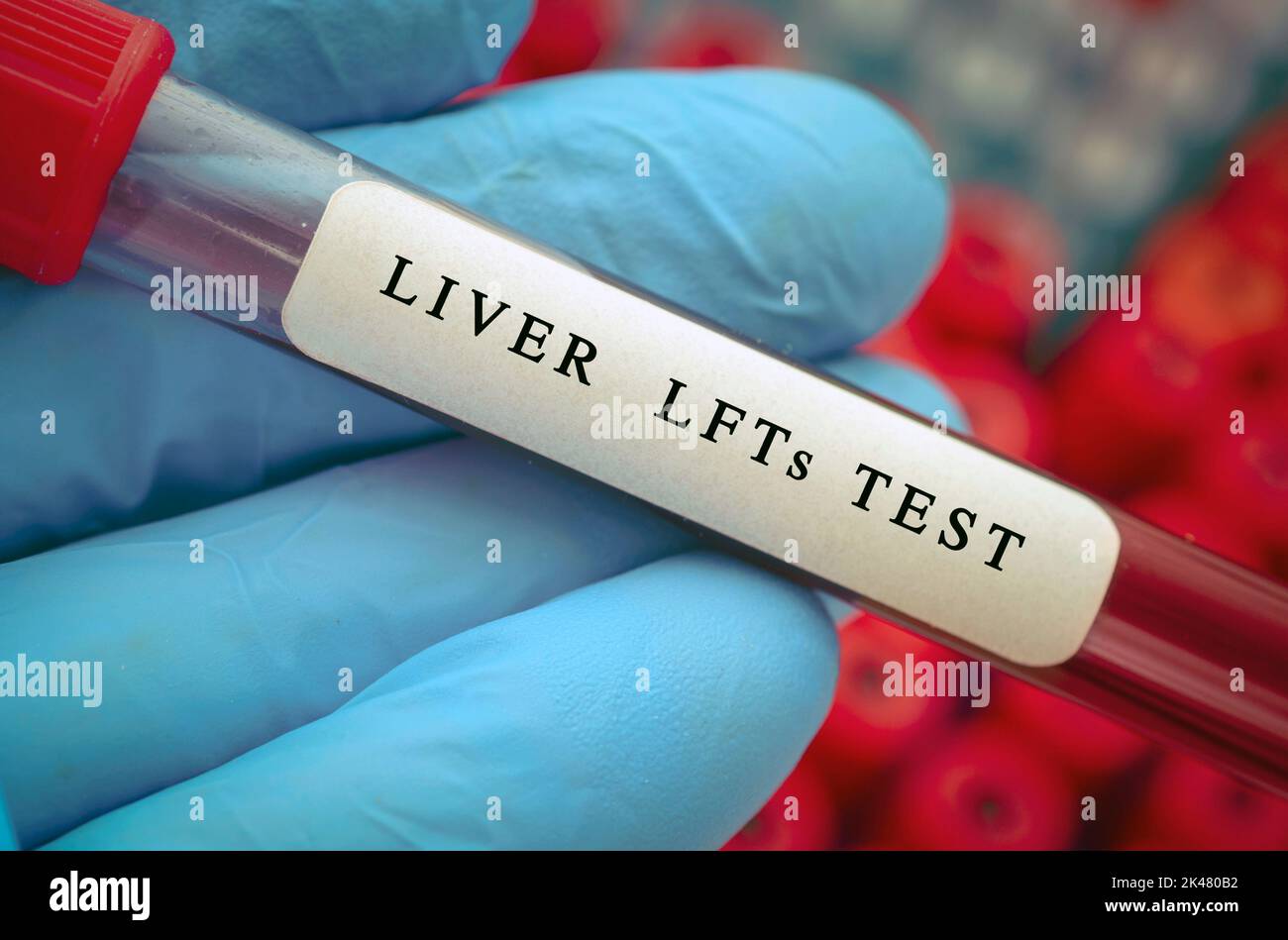 Liver function test, conceptual image Stock Photo - Alamy