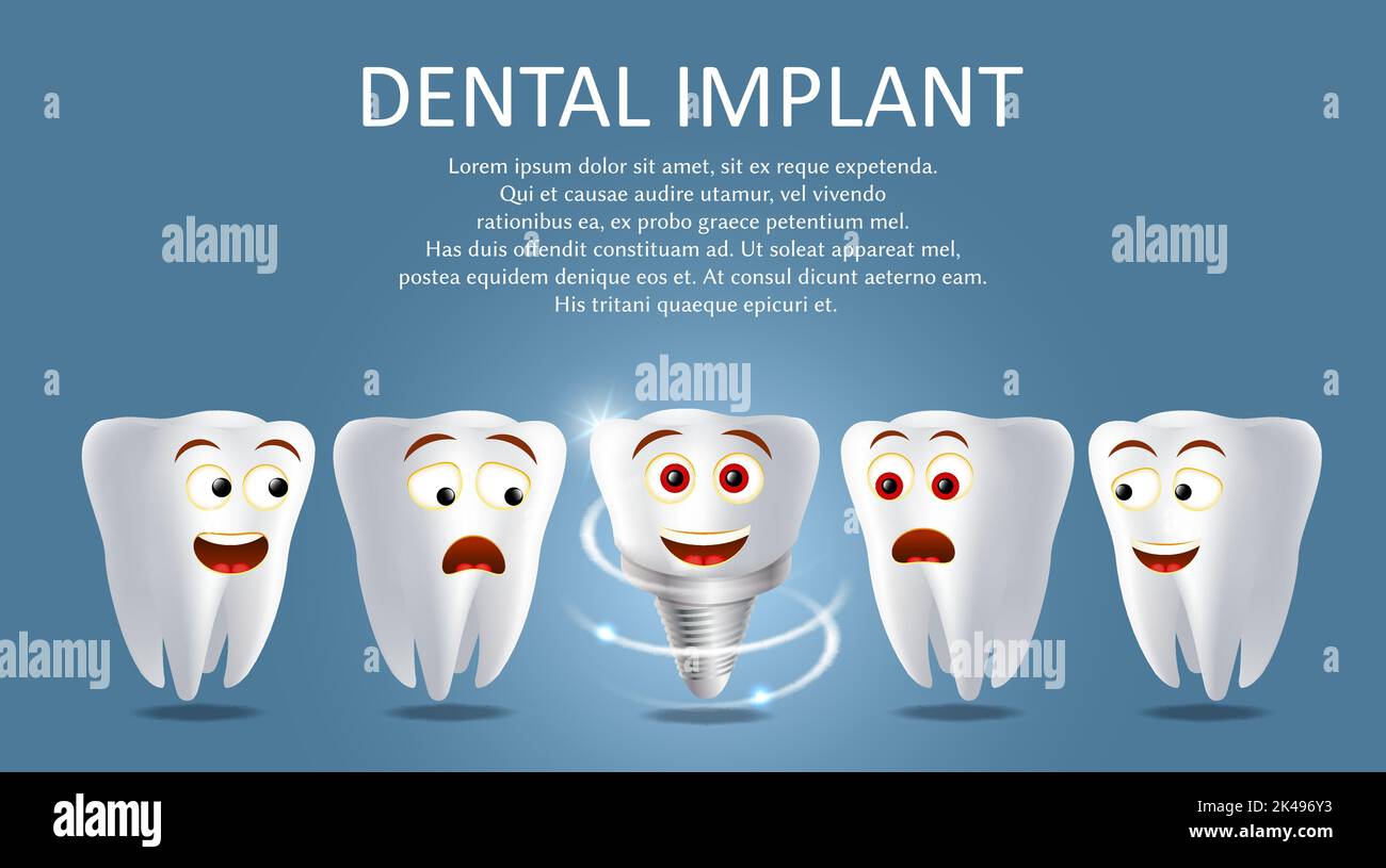 Dental implant poster banner template. Vector realistic illustration ...