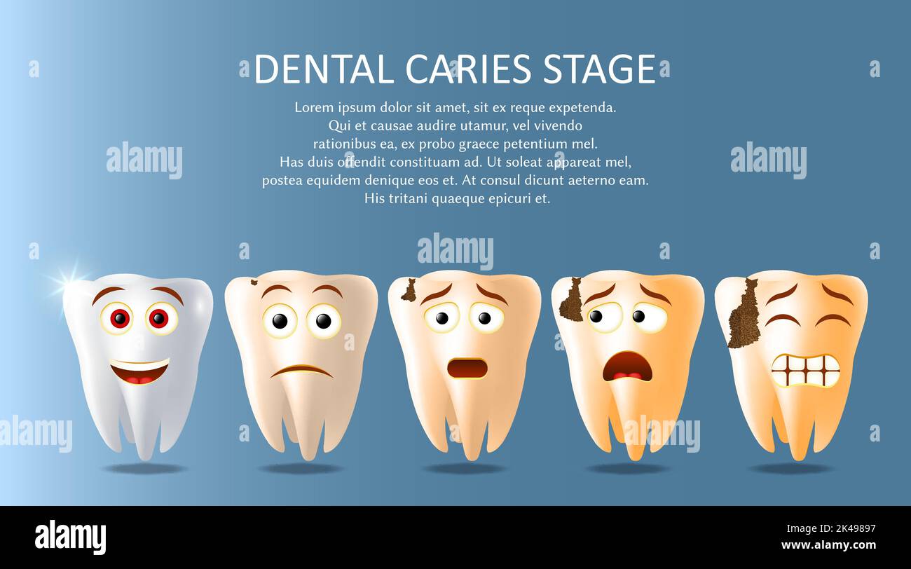 Dental caries stage vector poster banner template. Happy healthy tooth ...