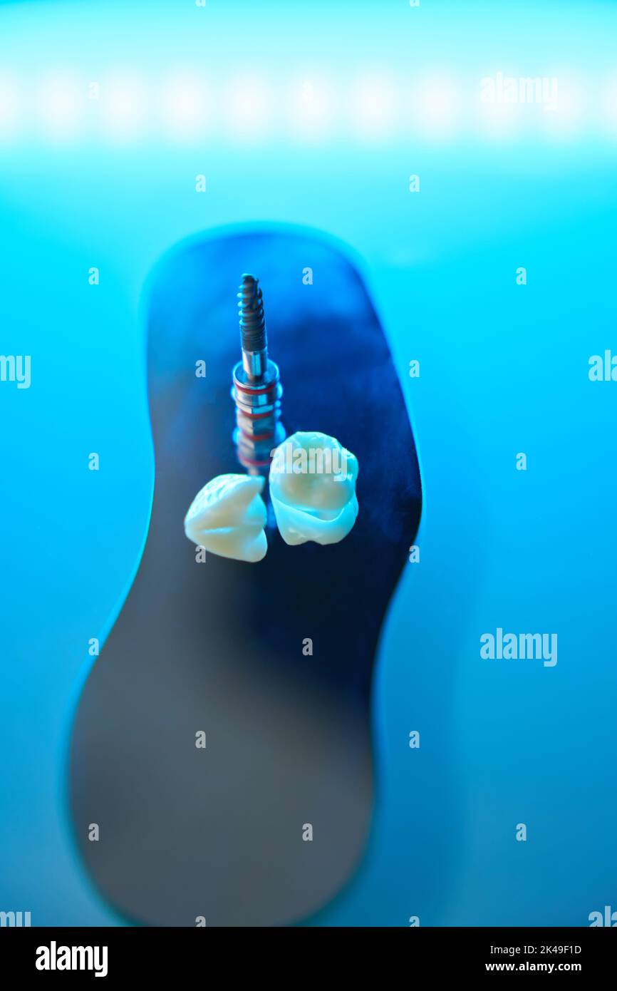 Close-up of pin and chewing teeth. Restoration of damaged teeth Stock ...