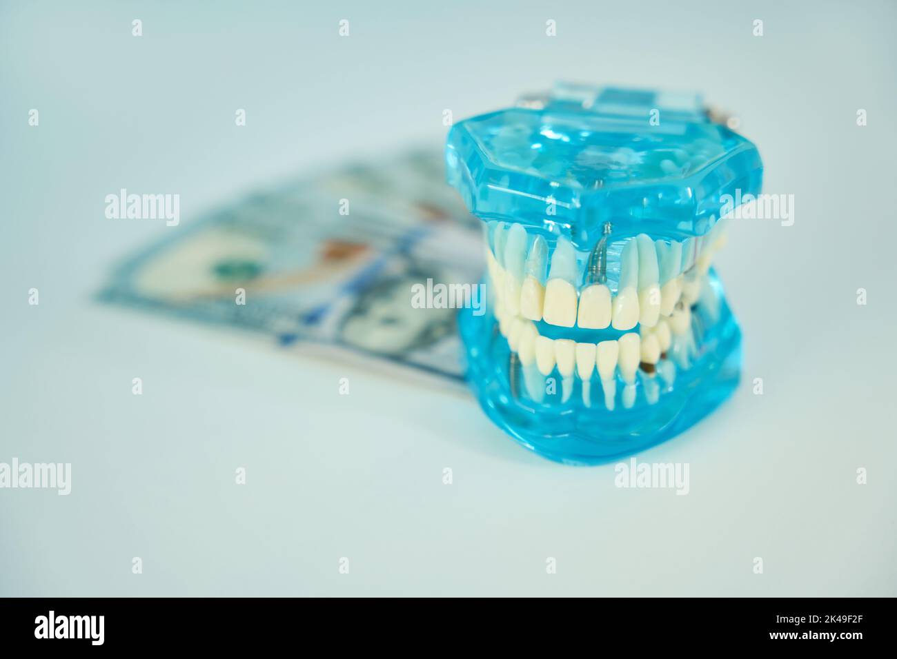 Model of blue human jaw with healthy and damaged teeth Stock Photo - Alamy