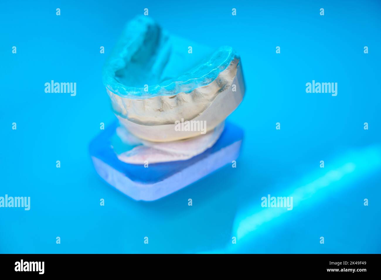 Photo of transparent orthodontic cap lying on cast of jaw Stock Photo ...