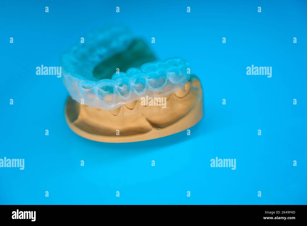 Close-up of tray for teeth alignment with cast of jaw Stock Photo - Alamy