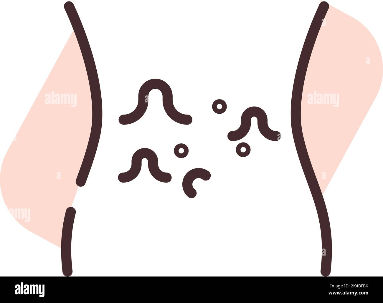 Allergy back acne, illustration, vector on white background Stock ...
