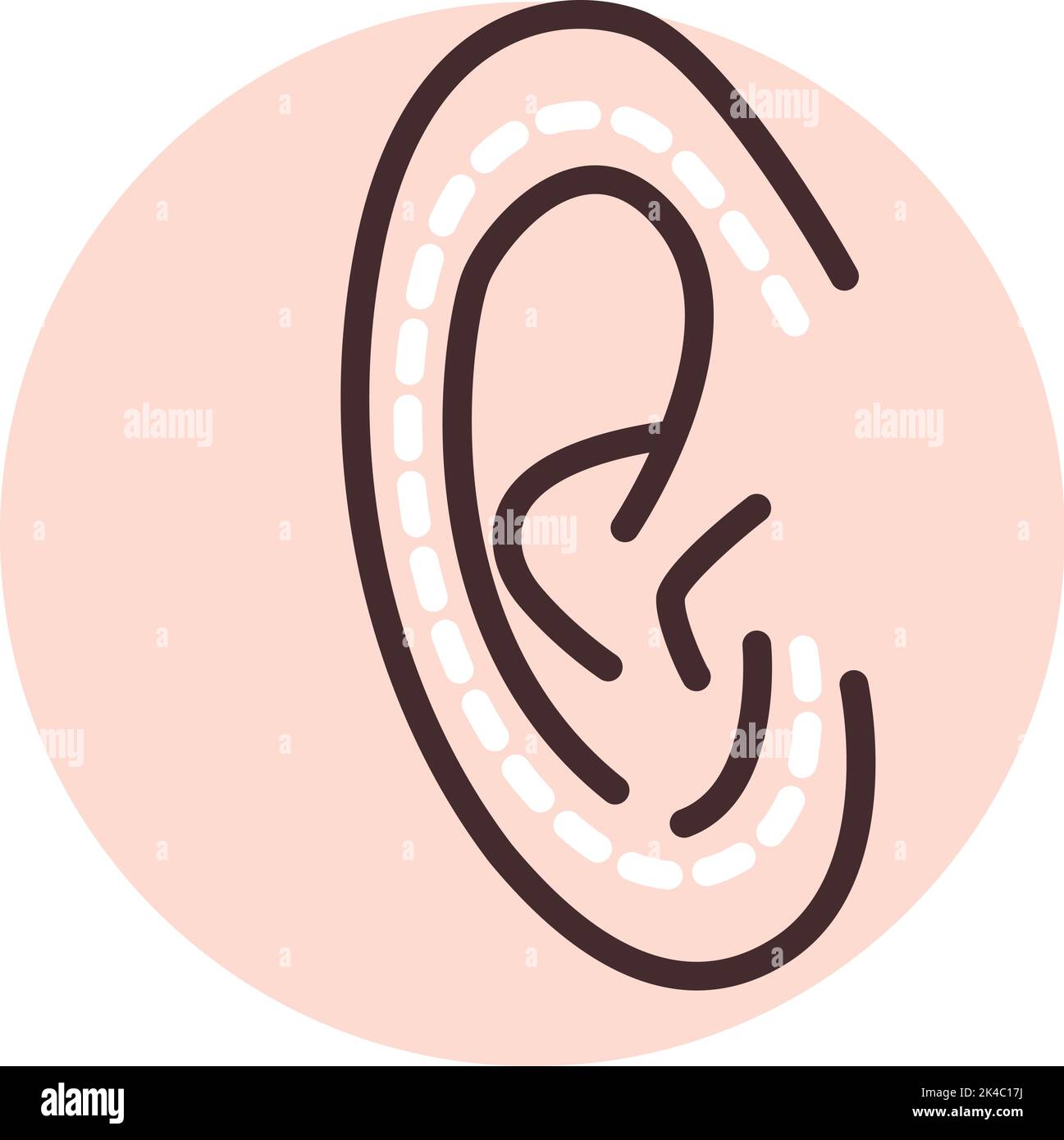 Ear surgery, illustration, vector on white background Stock Vector ...