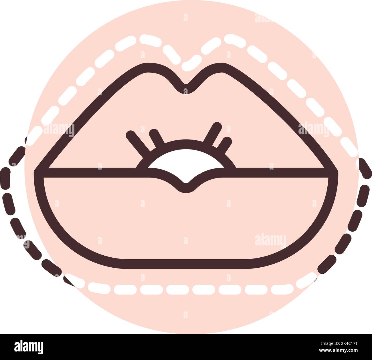 Lip surgery, illustration, vector on white background Stock Vector ...