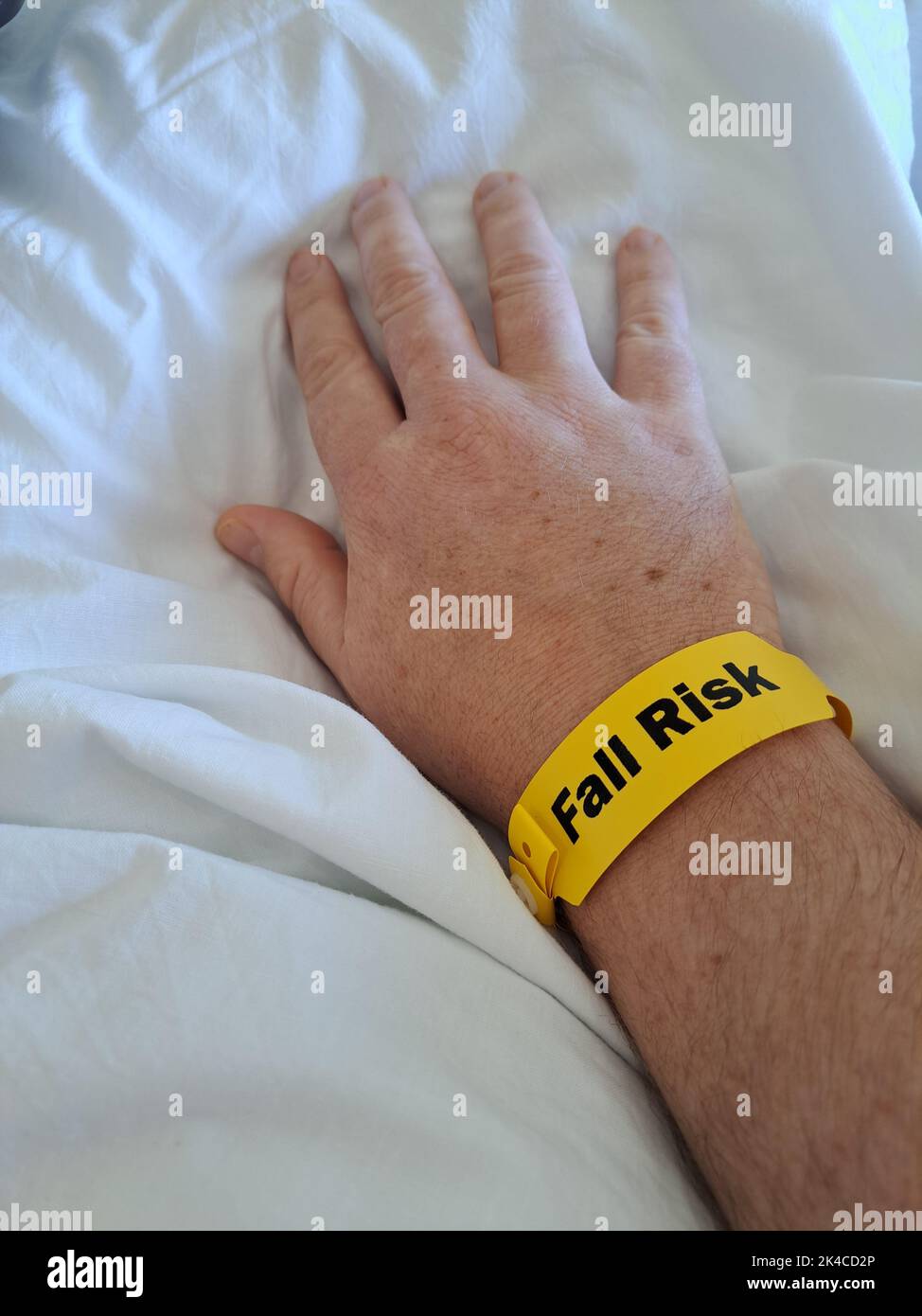 A patient hand on bed in hospital wearing a yellow armband to indicate ...