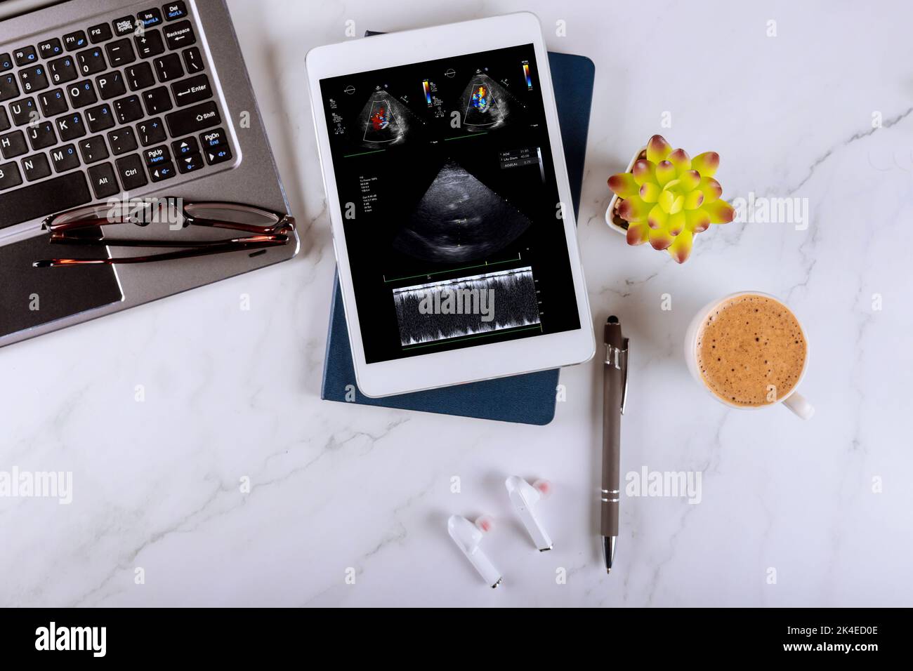 A doctor using a digital tablet examines the results of the ...