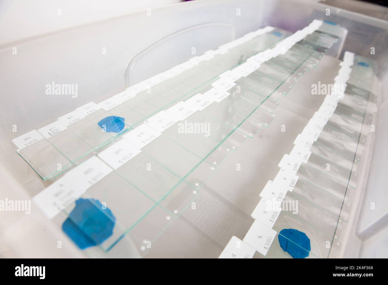 Scientist preparing slides with paraffin embedded tissue samples for ...