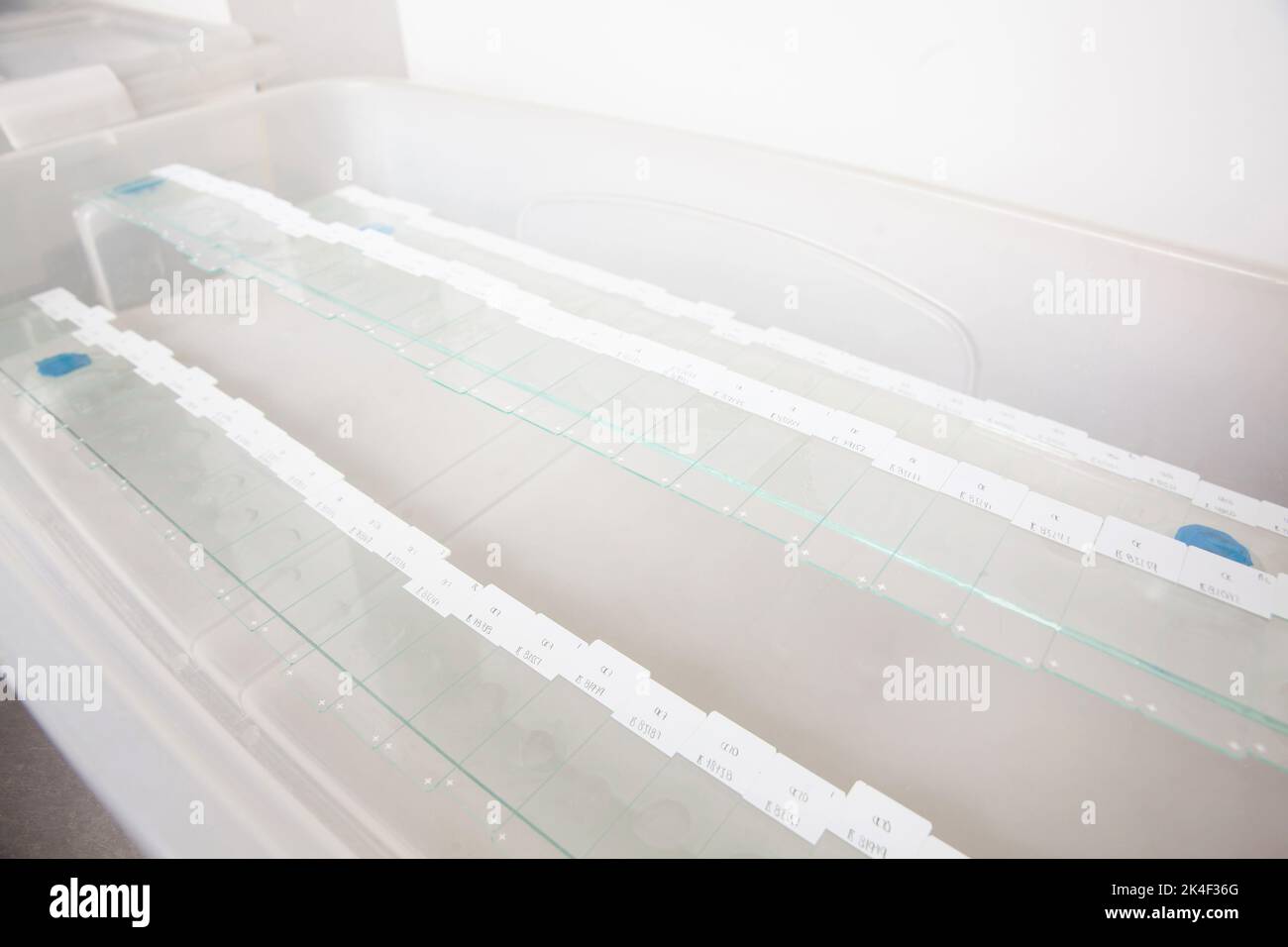 Scientist preparing slides with paraffin embedded tissue samples for ...