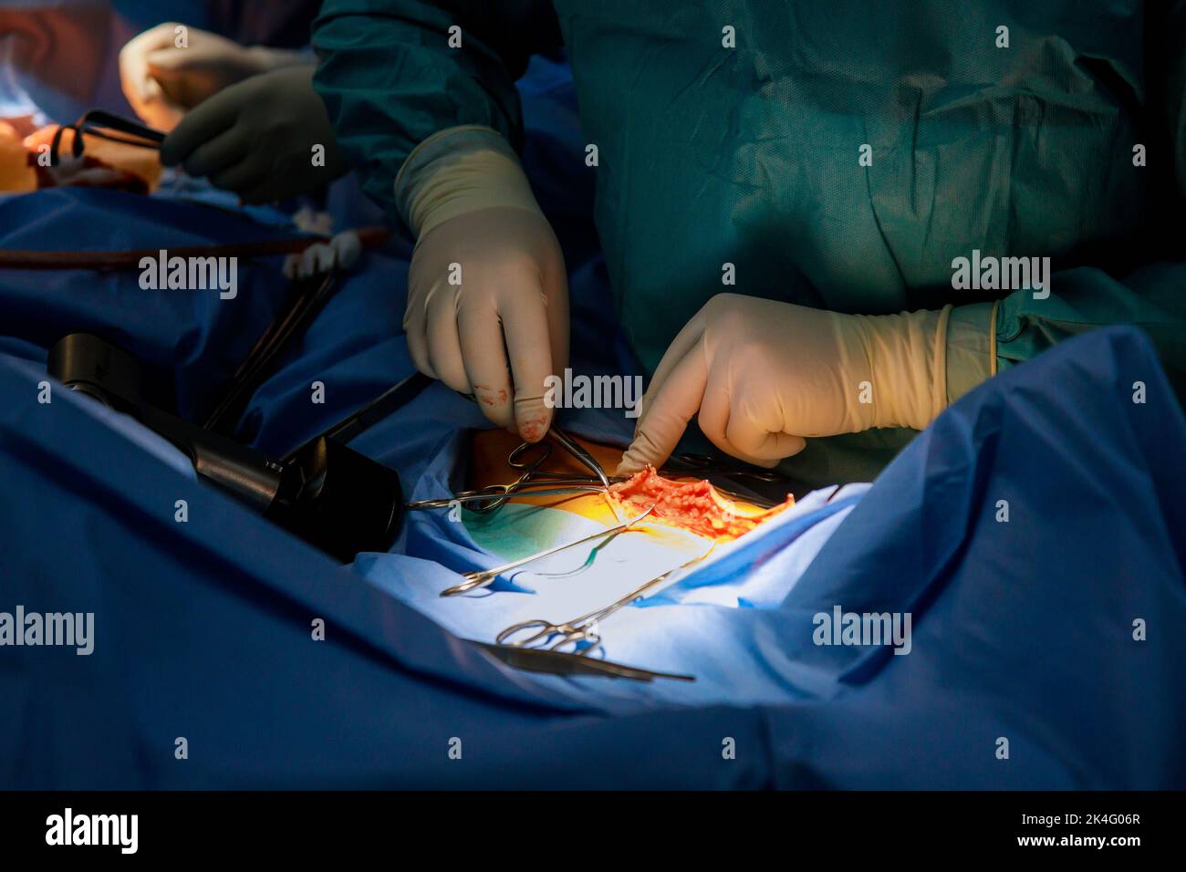 A doctor sews up a leg that has been injured in the operating room ...