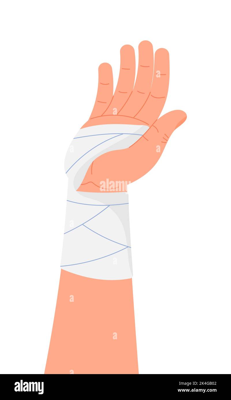 Broken arm vector. Hand tied with bandages, bandaged with plaster Stock ...