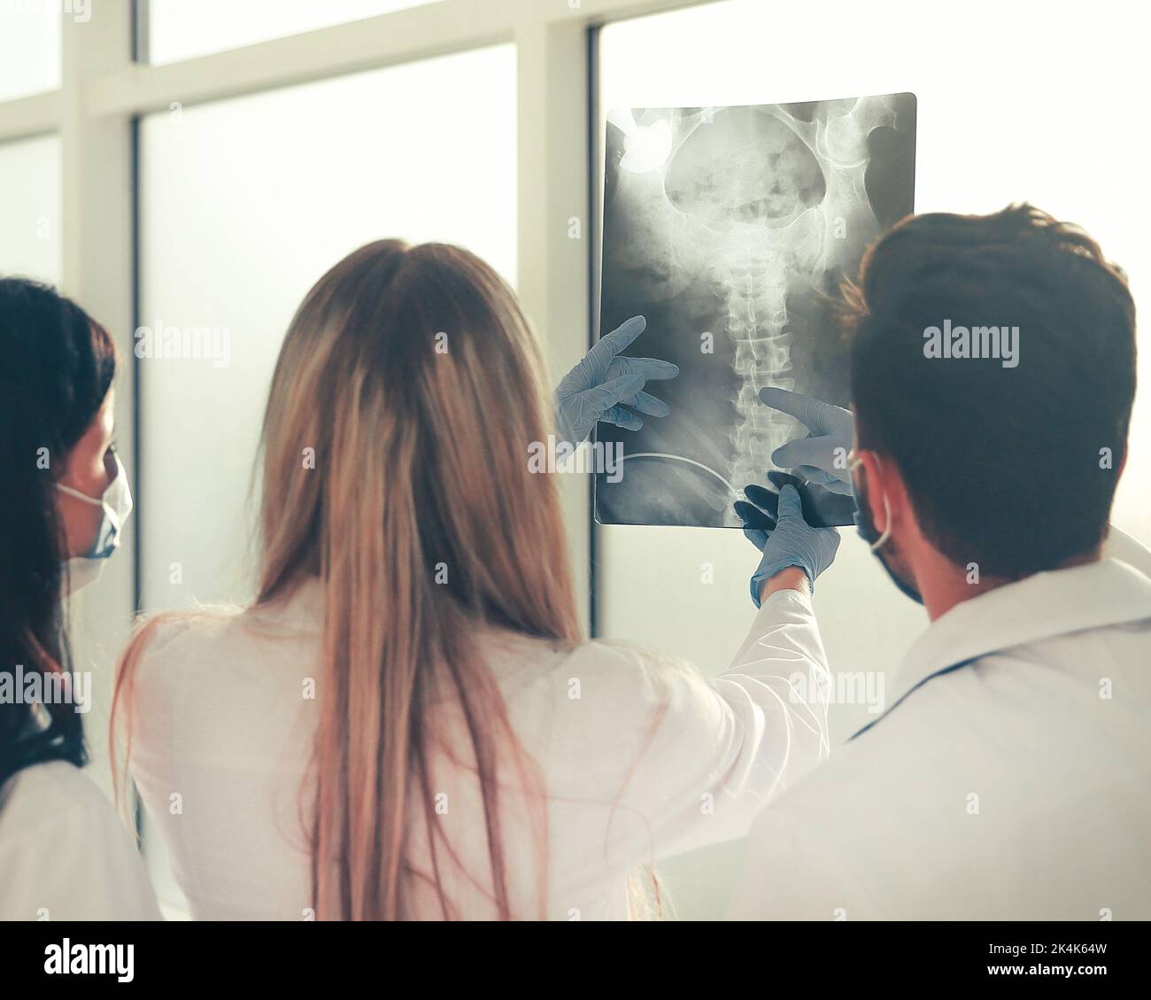 rear view. a group of surgeons discussing x-ray Stock Photo - Alamy