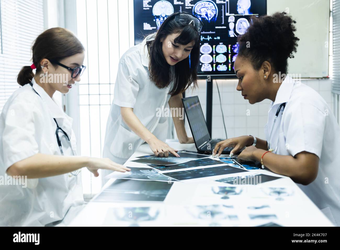 Team of female doctor check on scan results paper and looking at ...