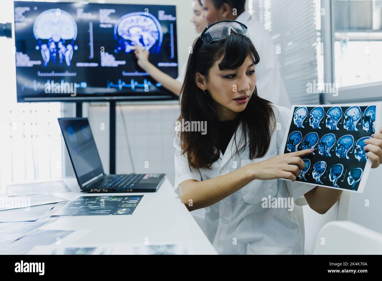 Team of female doctor check on scan results paper and looking at ...