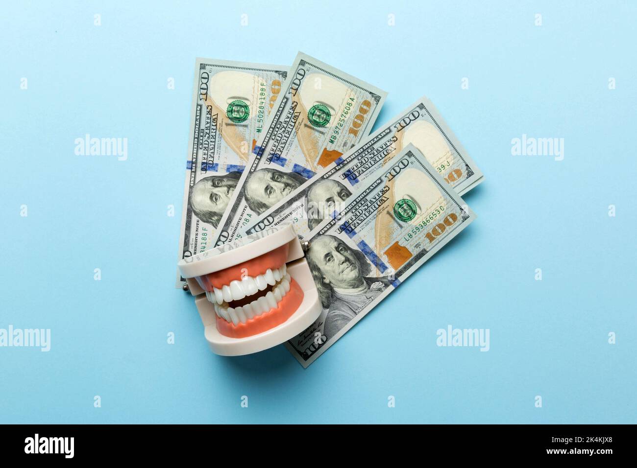 Closeup model of a human jaw with white teeth and dollar bill ...