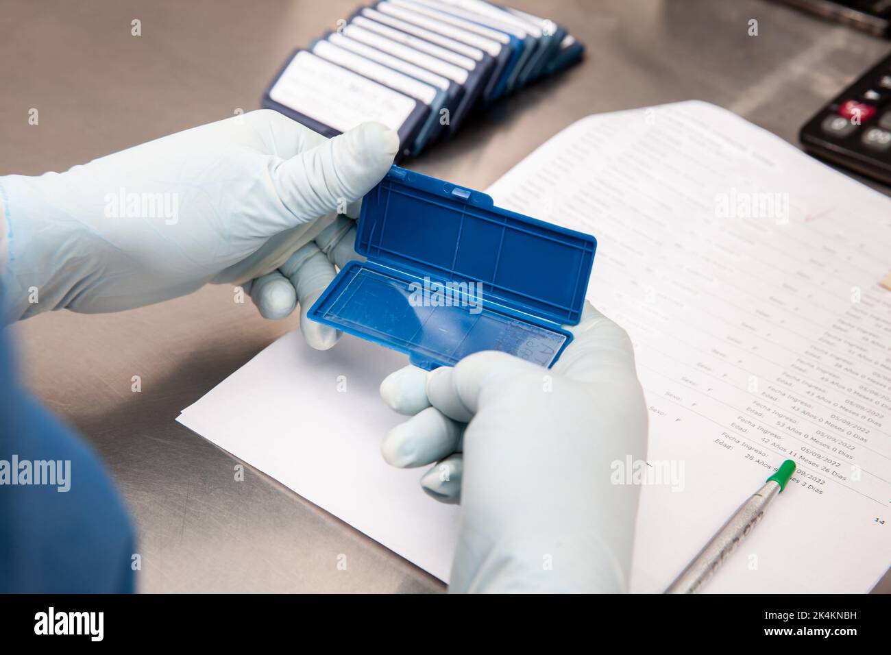 Laboratorian giving admission to pap smear samples in the laboratory ...