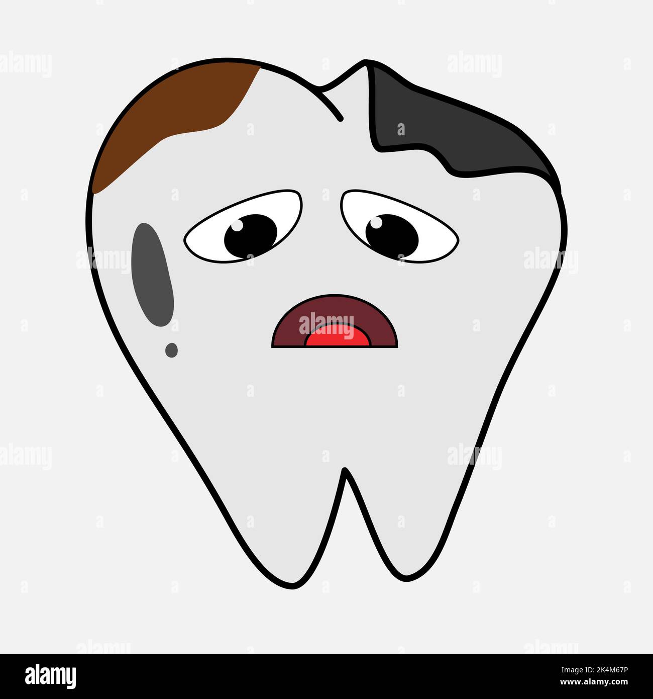 Tooth. The second stage of pulpitis. Treatment Stock Photo - Alamy