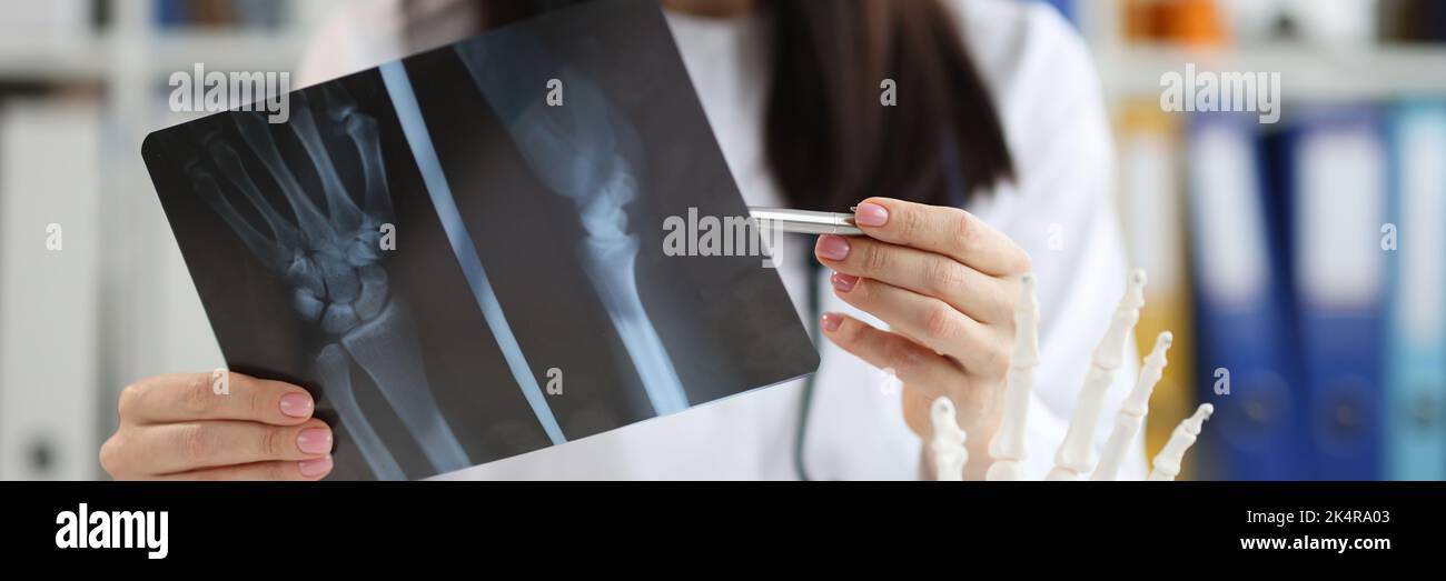 Doctor traumatologist examines x-ray with arm injury closeup Stock ...
