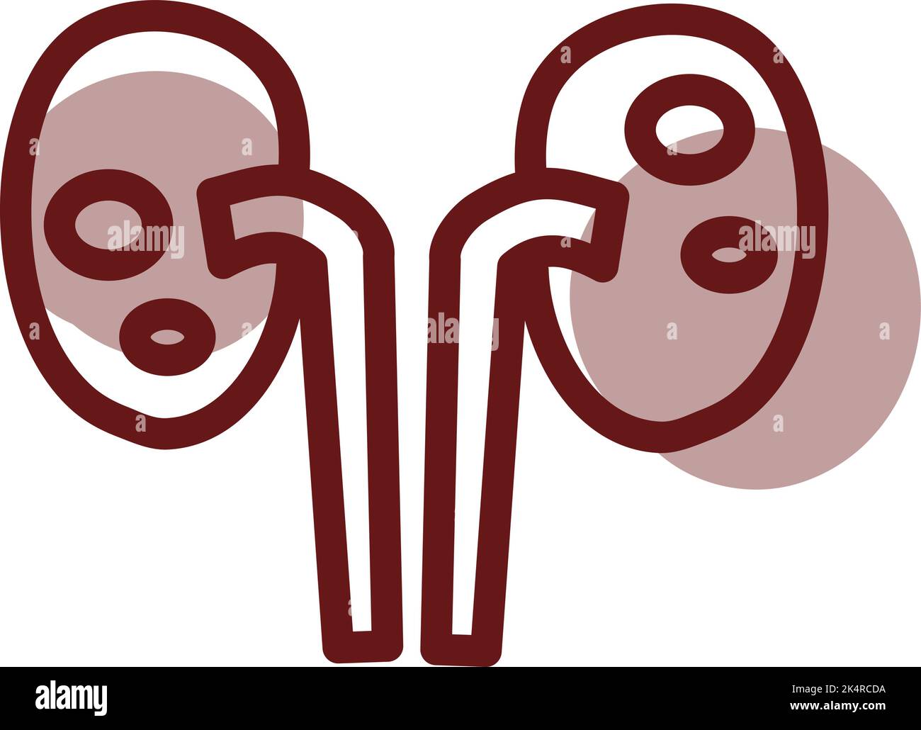 Kidney stones, illustration, vector on a white background Stock Vector ...
