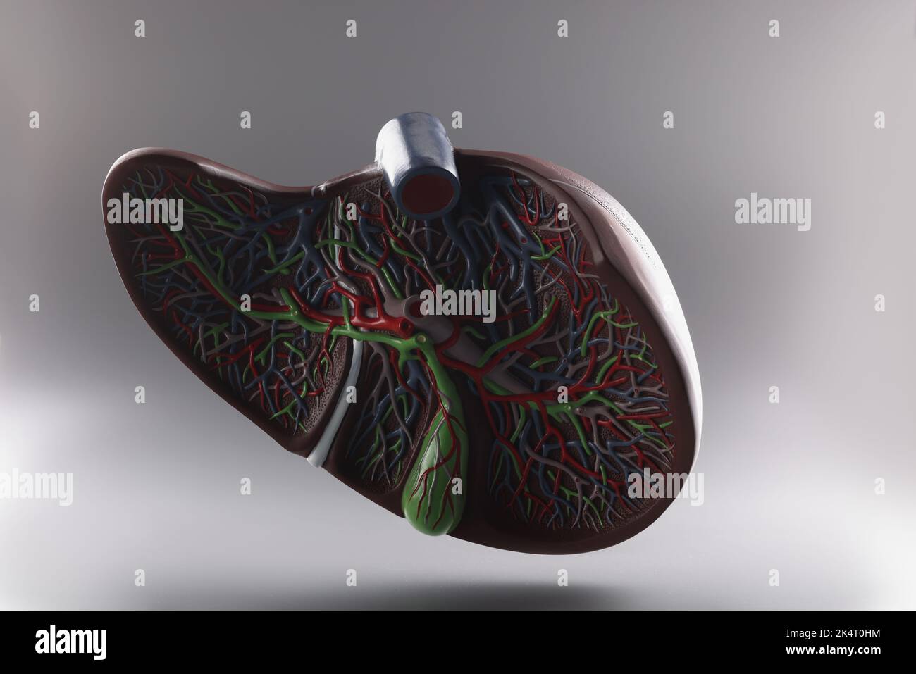 Liver Model Labeled