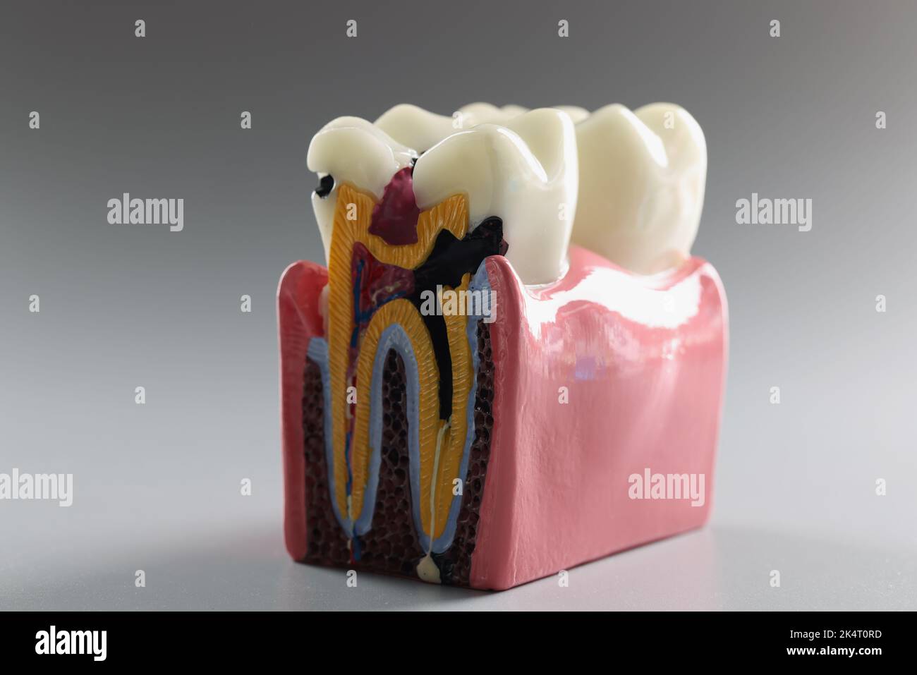 Teaching model of a tooth in cross section, close-up Stock Photo - Alamy