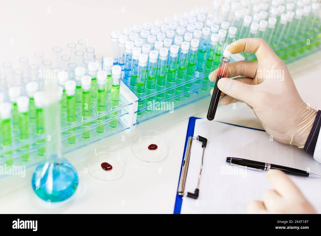 Laboratory. Blood sample in researcher's hands. Close-up. View from the ...