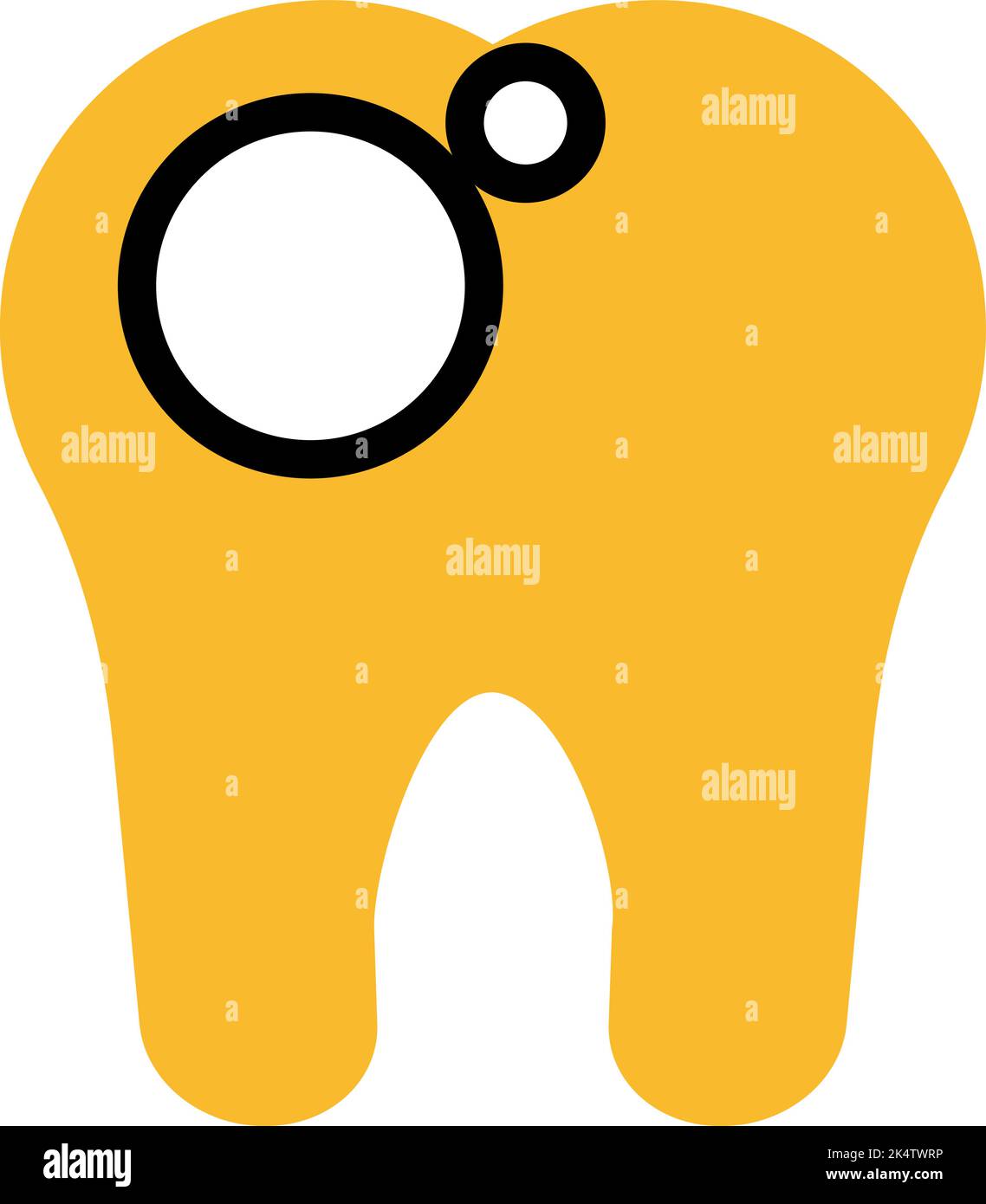 Tooth caries, illustration, vector on a white background Stock Vector ...