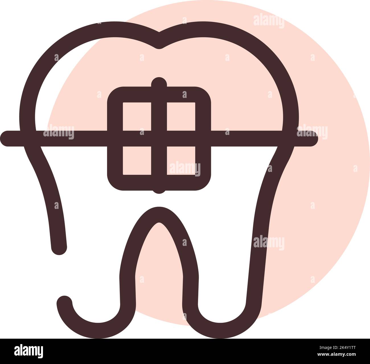 Tooth braces, illustration, vector on a white background Stock Vector ...
