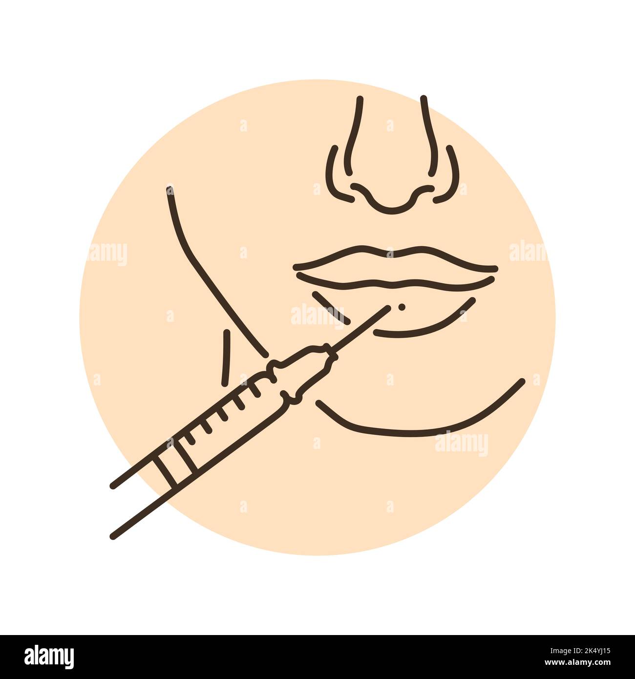 Lips augmentation color line illustration. Hyaluronic injection Stock ...