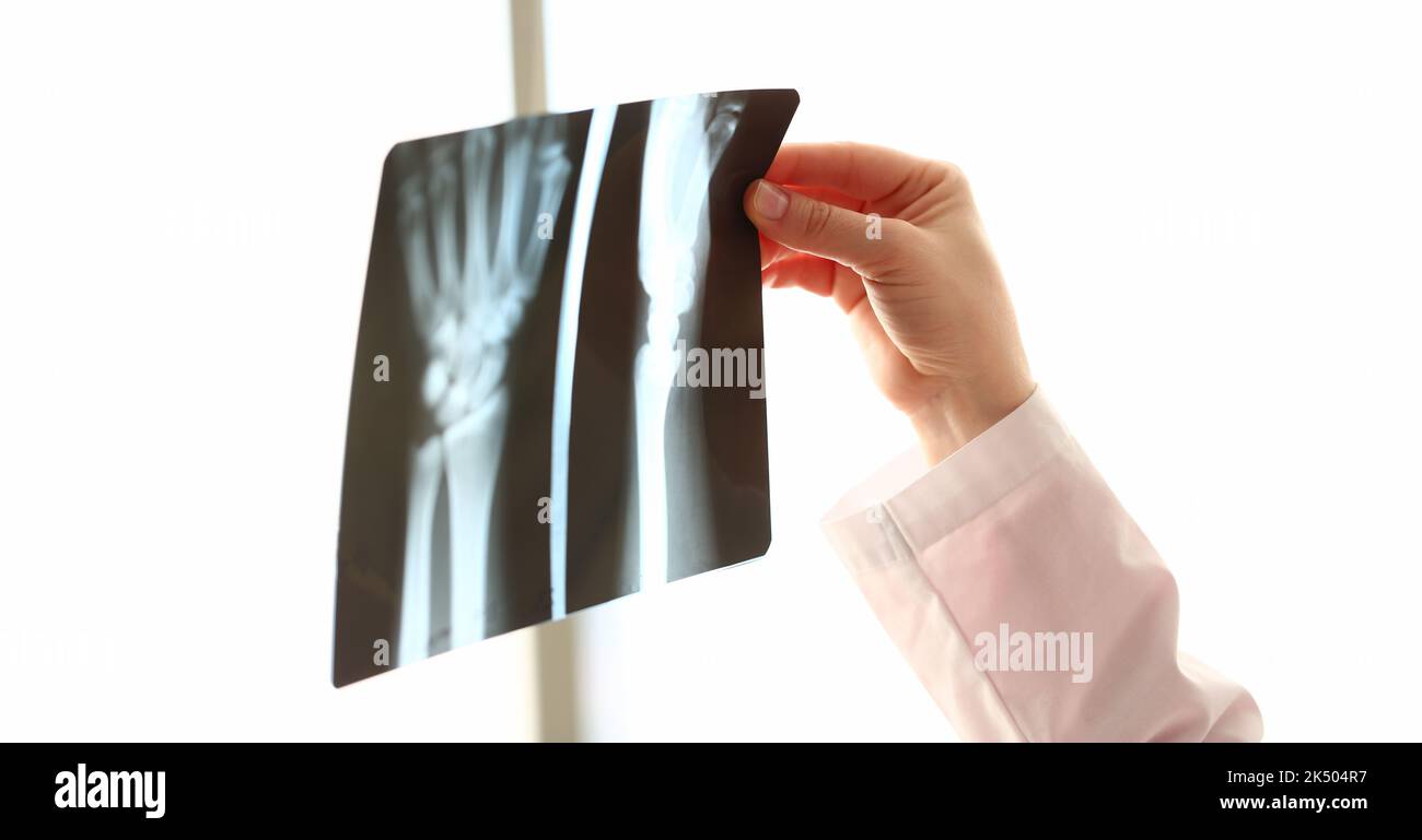 Female patient orthopedic medical Cut Out Stock Images & Pictures - Alamy