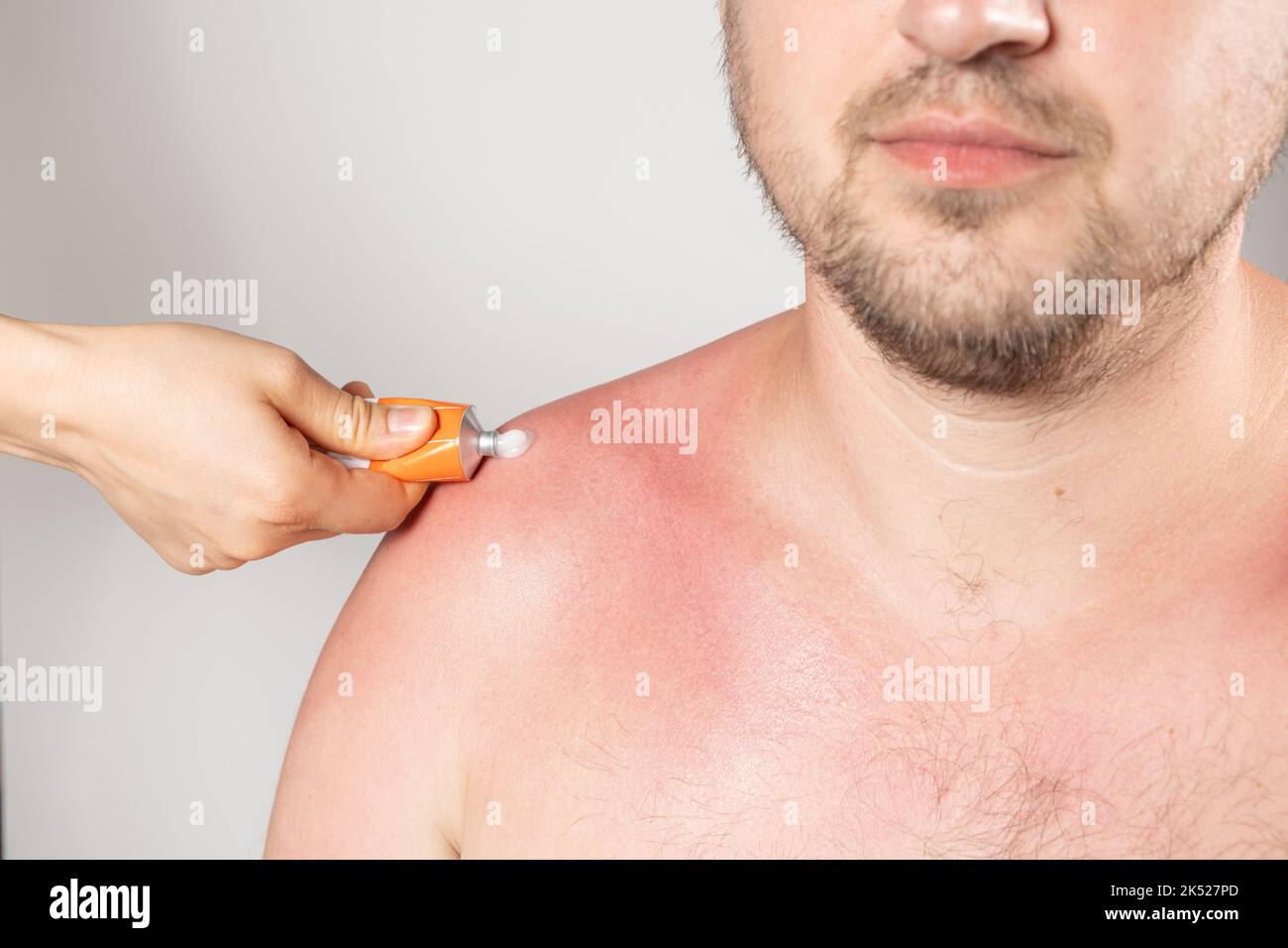 Person sunbathing exposure hi-res stock photography and images - Alamy