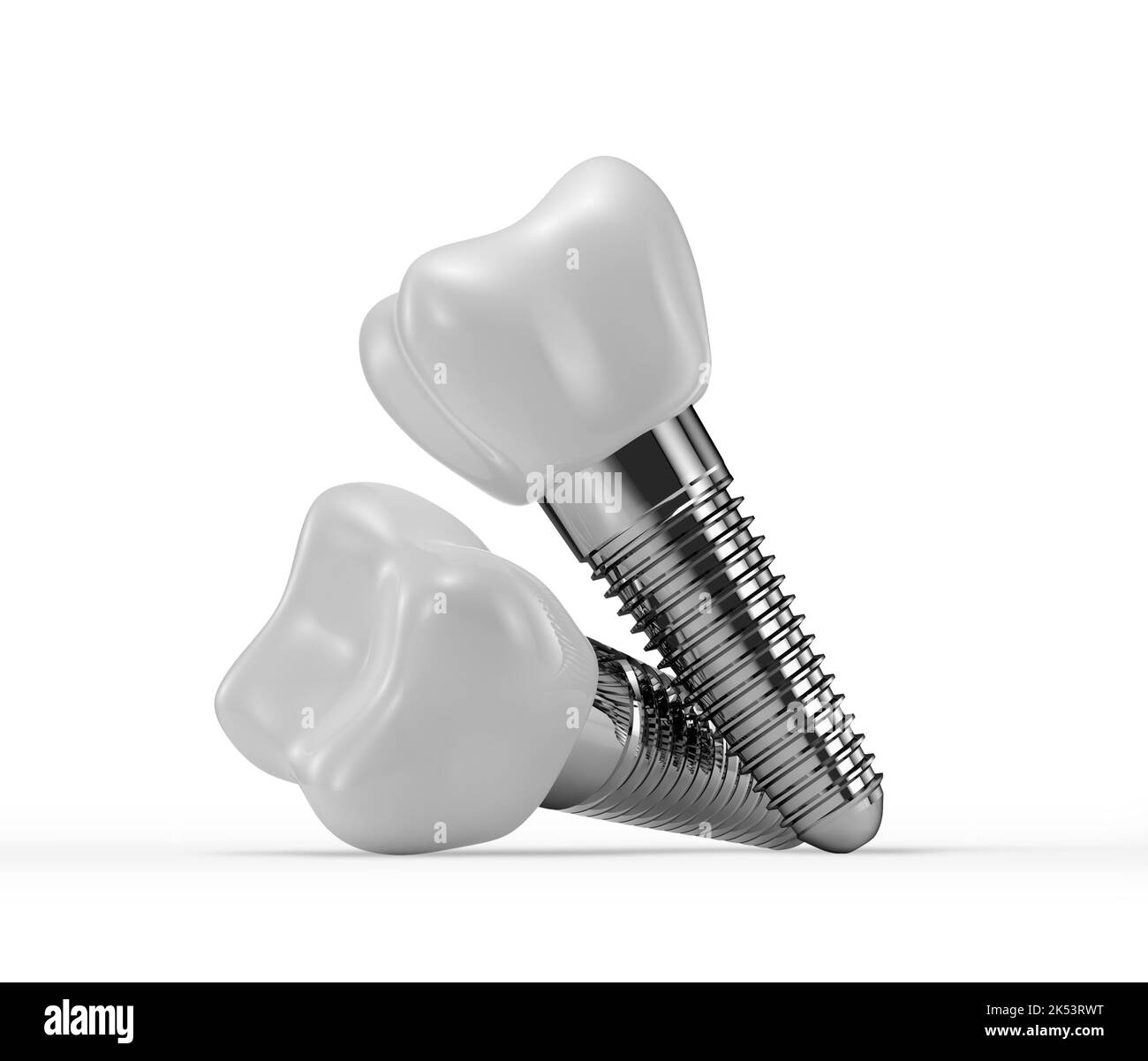 dental implants isolated on a white background. 3d rendering Stock ...