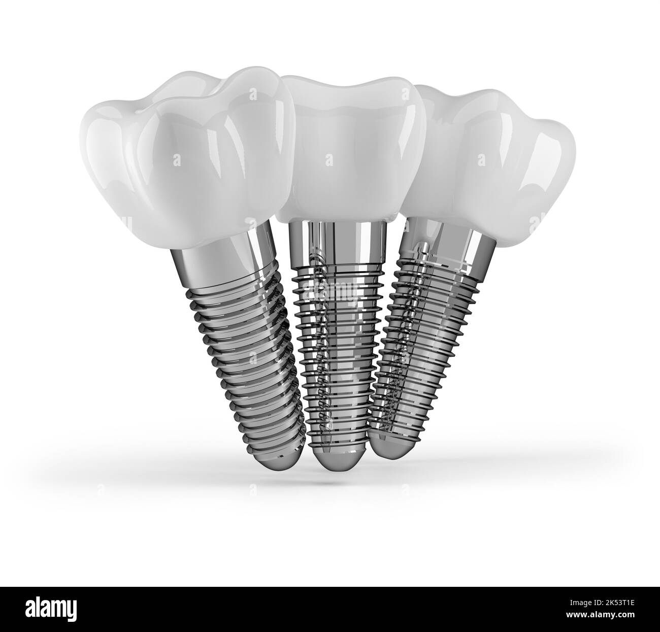 dental implants isolated on a white background.3D rendering Stock Photo ...
