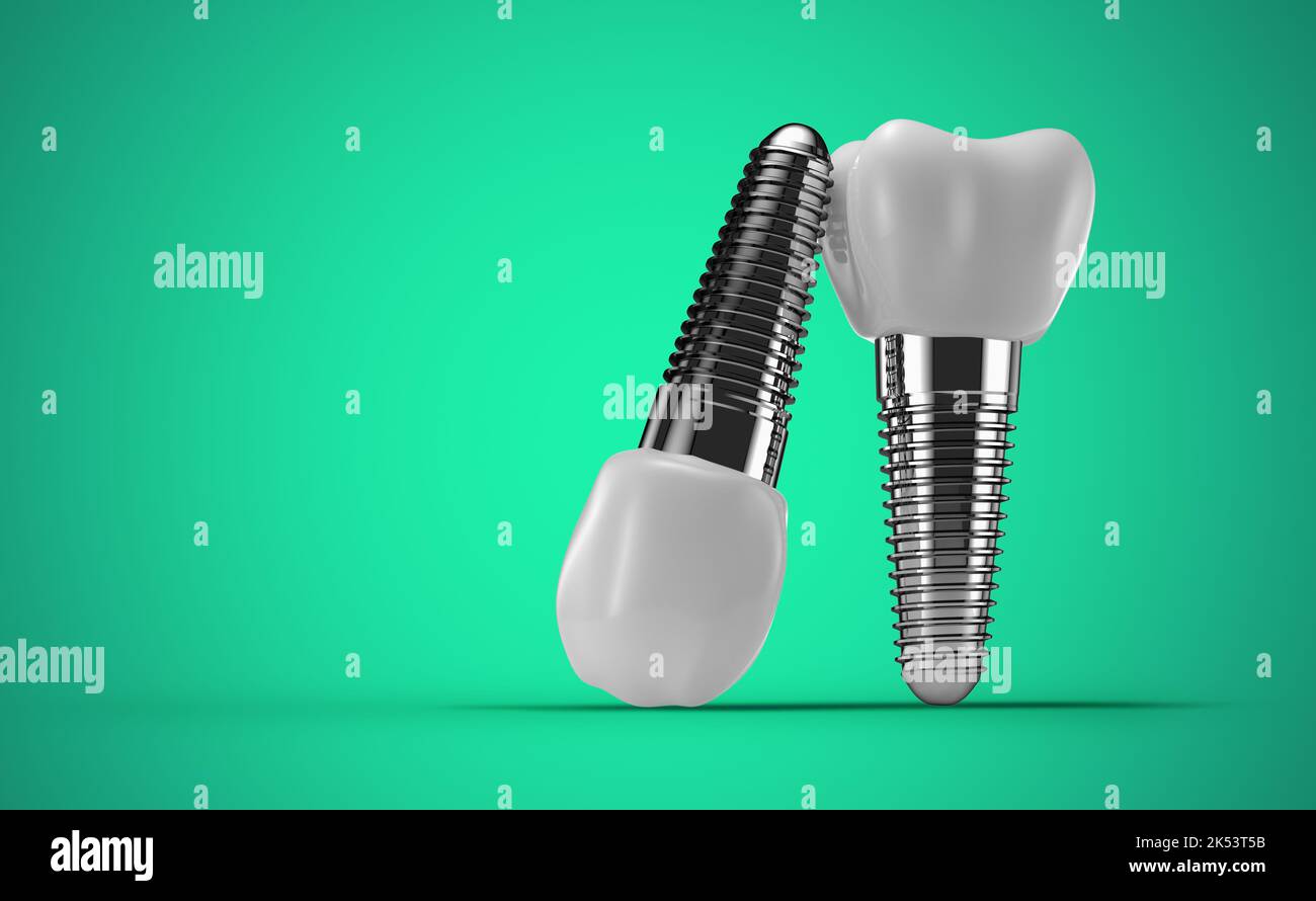 Dental Implant Wallpaper