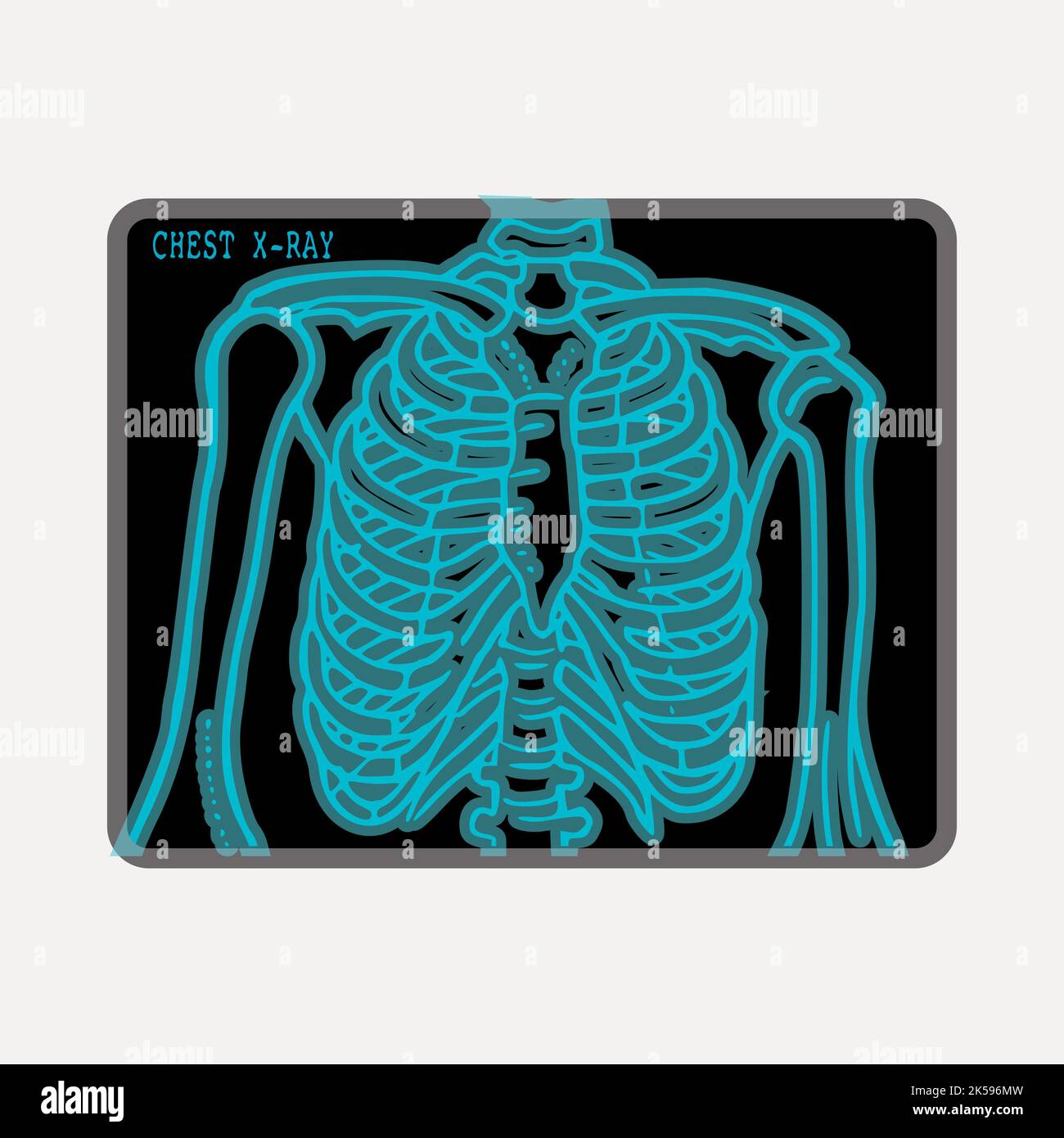 Chest Xray Stock Illustration Image Of Skeleton Vector