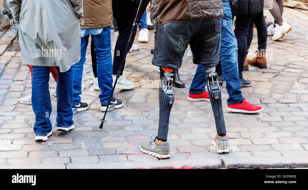 Hamburg, Germany. 04th Oct, 2022. A pedestrian with two prosthetic thighs stands on cobblestones ...