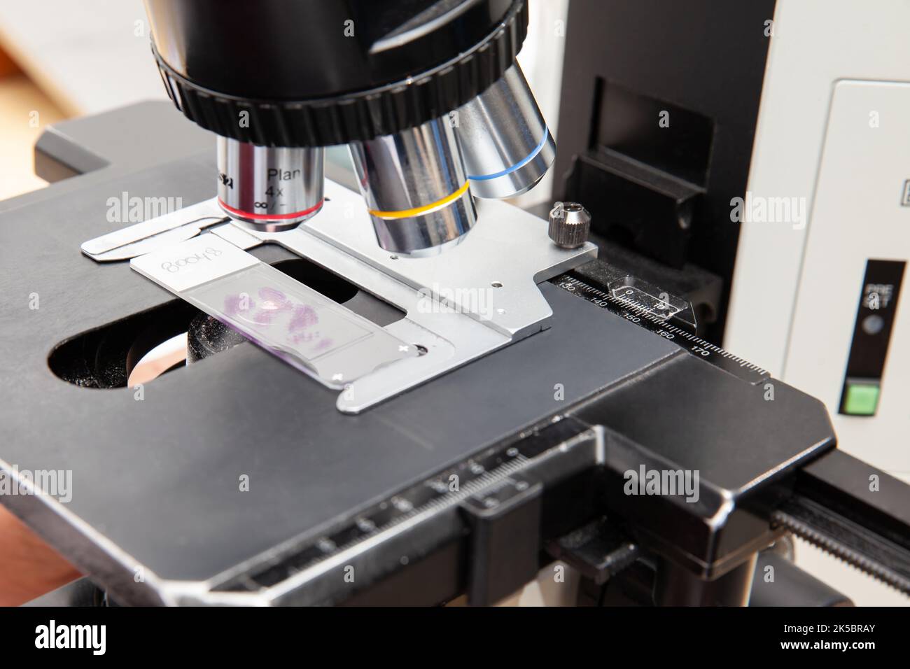 Closeup of a microscope slide with stained tissue biopsy under the ...