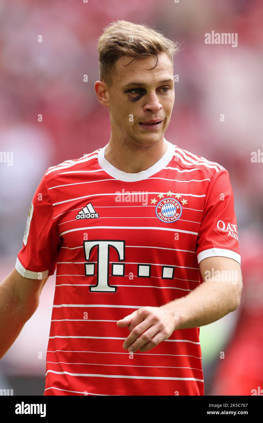 Joshua Kimmich of Bayern Muenchen mit blauen Auge FC Bayern Muenchen ...