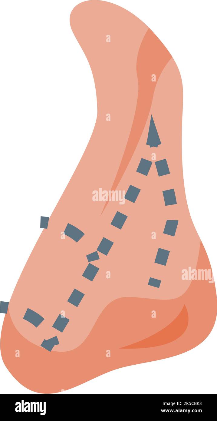 Rhinoplasty icon isometric vector. Nose surgery. Plastic open Stock ...