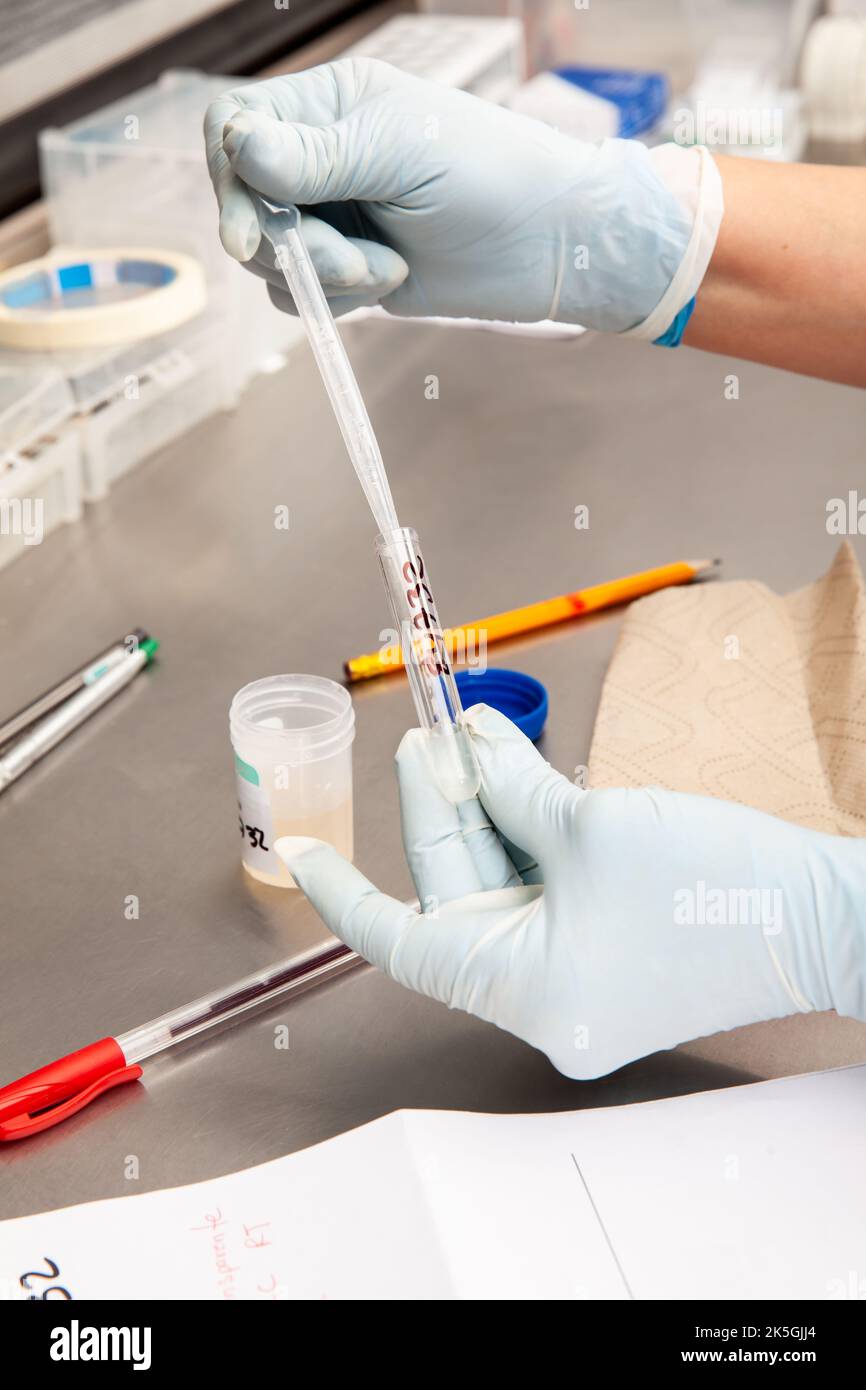 Cytology hi-res stock photography and images - Alamy
