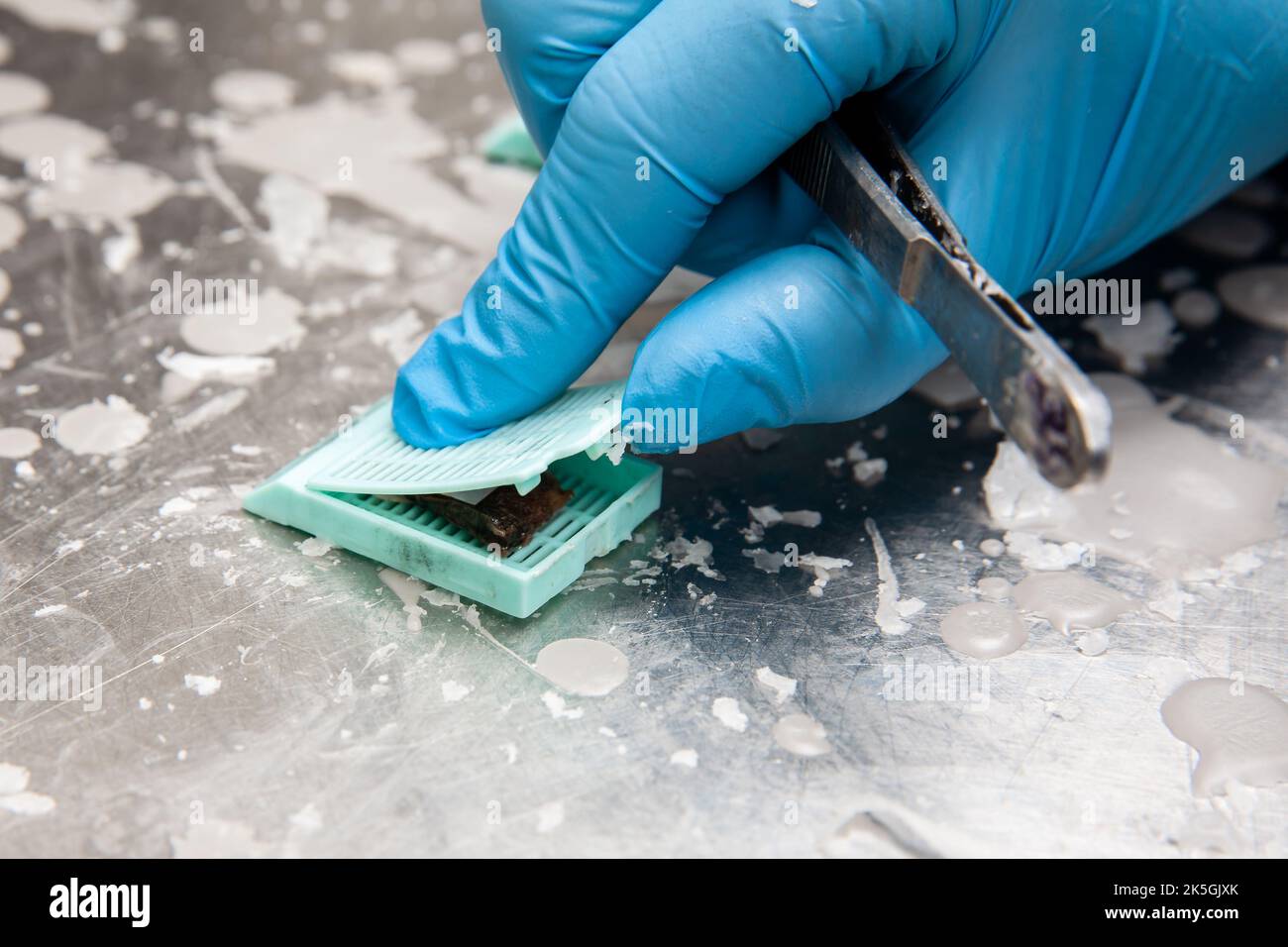 Cassette containing a biopsy sample. Scientist embedding tissues in ...