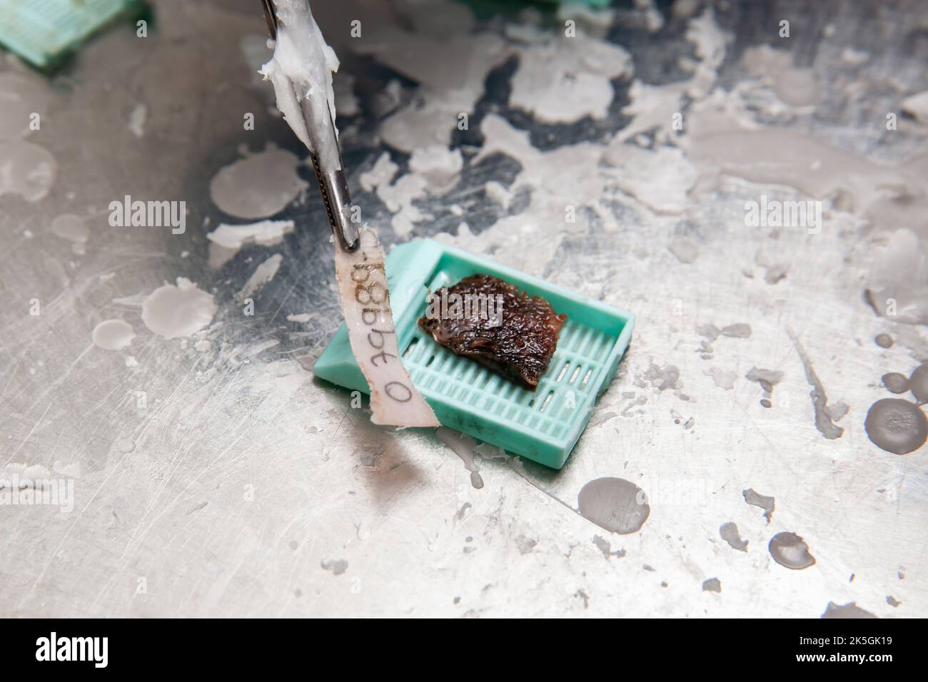 Identify diagnosis hi-res stock photography and images - Alamy