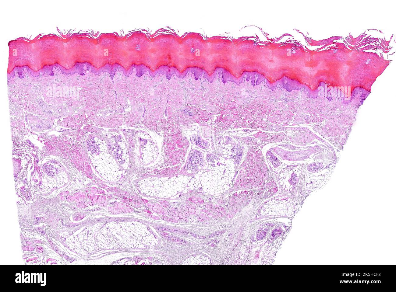 Low power light microscope micrograph of human glabrous skin. From top ...