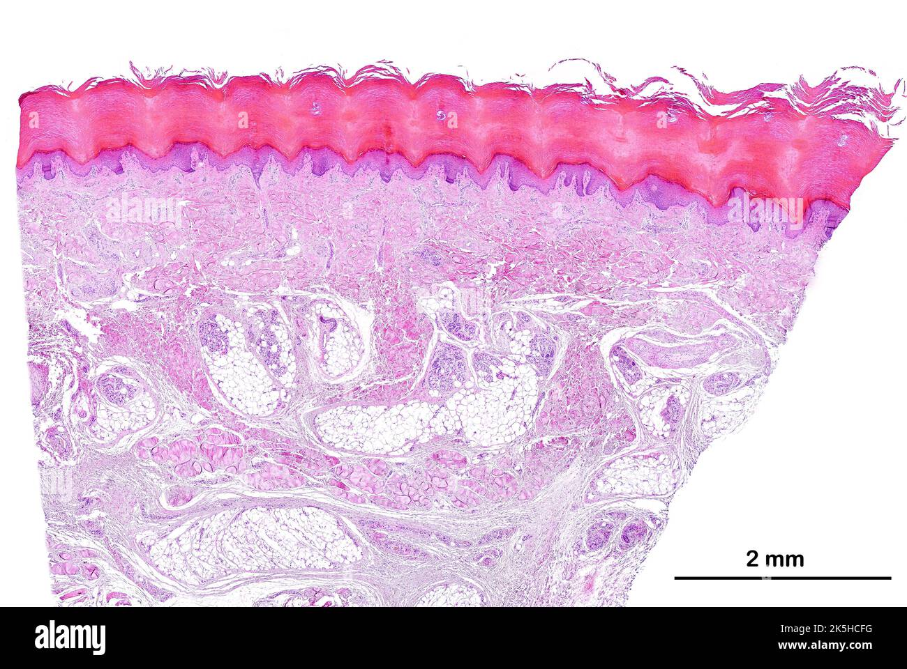 Low power light microscope micrograph of human glabrous skin. From top ...