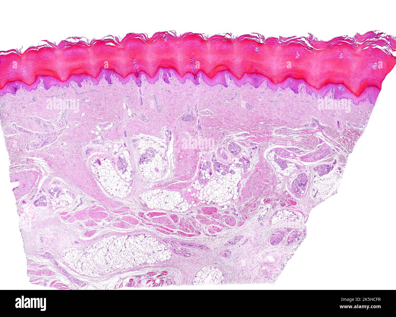 Low power light microscope micrograph of human glabrous skin. From top ...