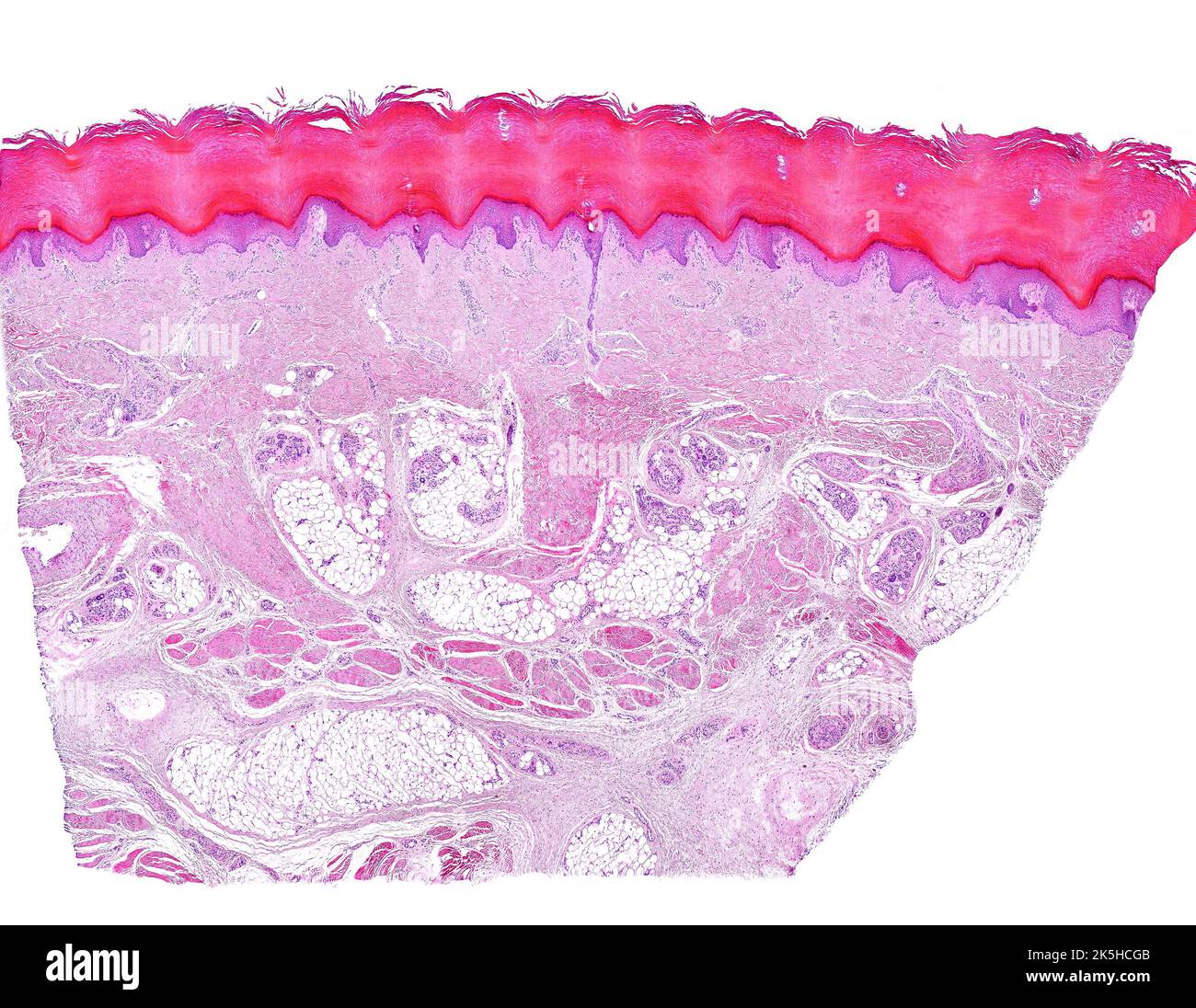 Low power light microscope micrograph of human glabrous skin. From top ...