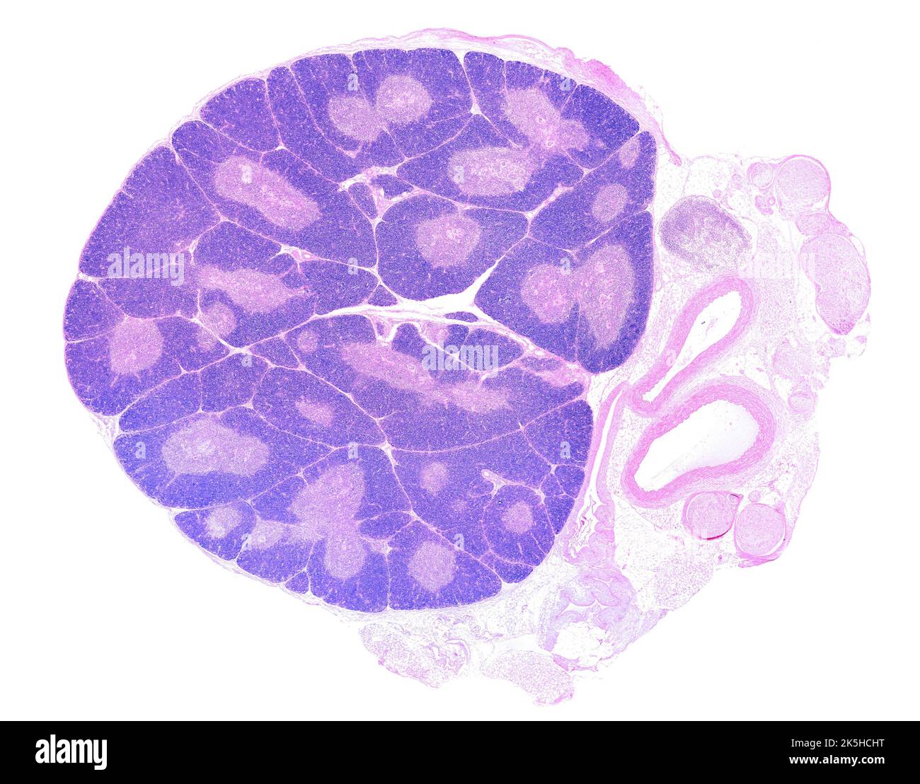 Low power light microscope micrograph showing a young thymus. The ...